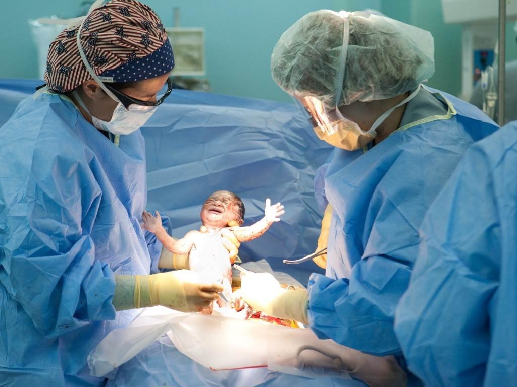 C Section Cesarean Section Procedure Risks And Recovery Doctor Zara