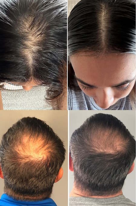 Scalp Massage for Hair Growth, Benefits, Techniques and Results ...