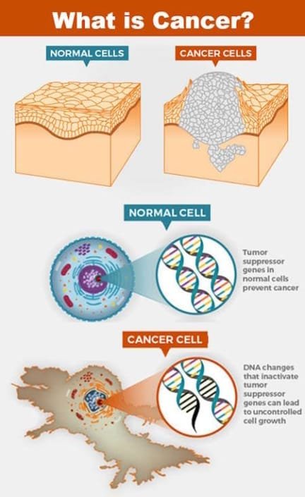 What Is Cancer? Symptoms, Causes, Types & Treatment - Doctor Zara