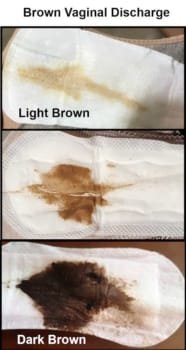 Brown Vaginal Discharge: Causes, Treatment, and When to get Tested ...