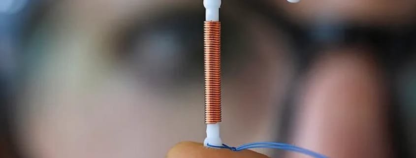 IUD Insertion Pain: Duration, Level, and Management - Doctor Zara