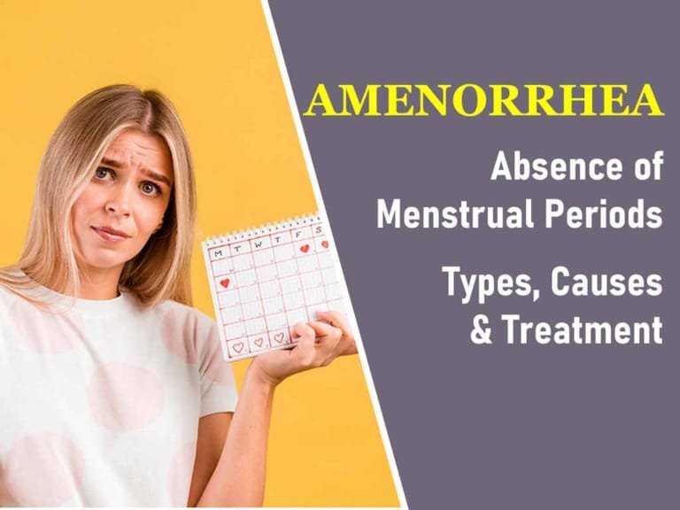Absence of Menstrual Periods (Amenorrhea): Types, Causes & Treatment ...