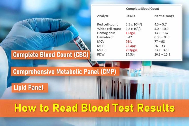 How to Read Blood Test Results: A Simple Guide to Your Lab Report ...